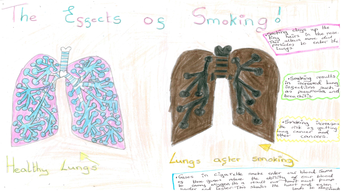 Smoking Is Bad For Your Health Poster