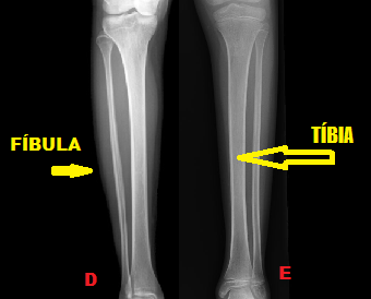 Estudo Radiográfico : COMO IDENTIFICAR O LADO DIREITO/ESQUERDO NA ...