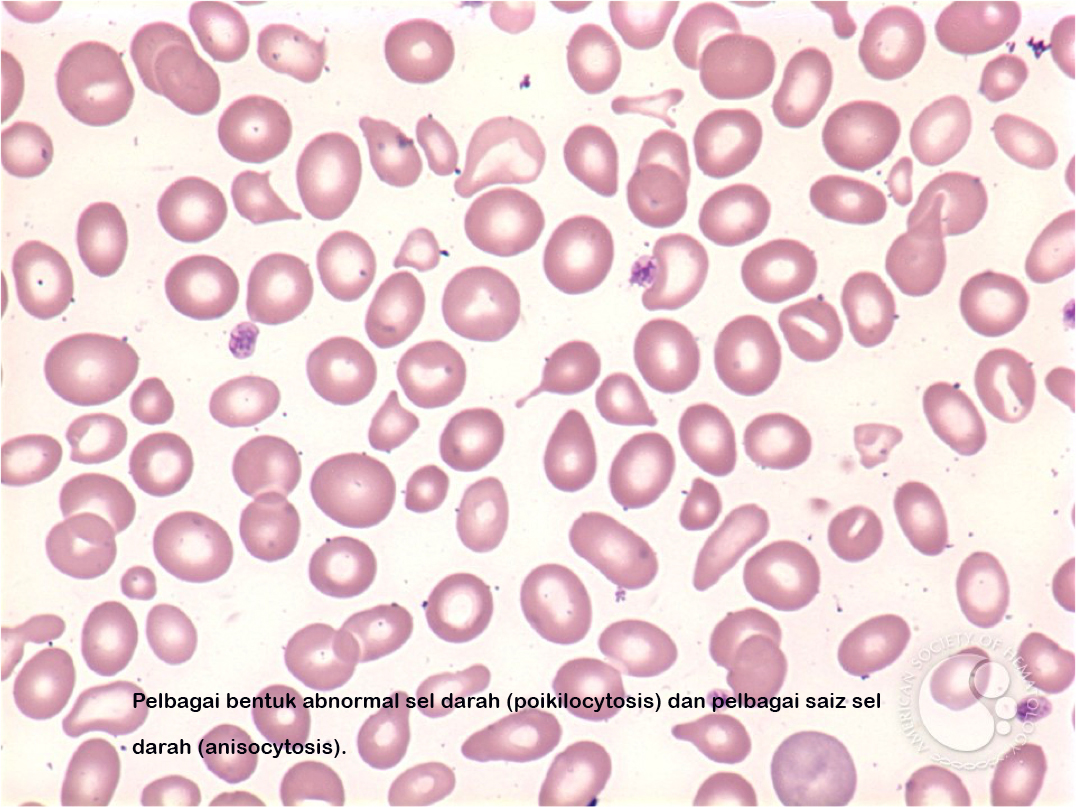 Blog Juruteknologi Makmal Perubatan @ MAD LAB BLOG: SMEAR SEL DARAH NORMAL