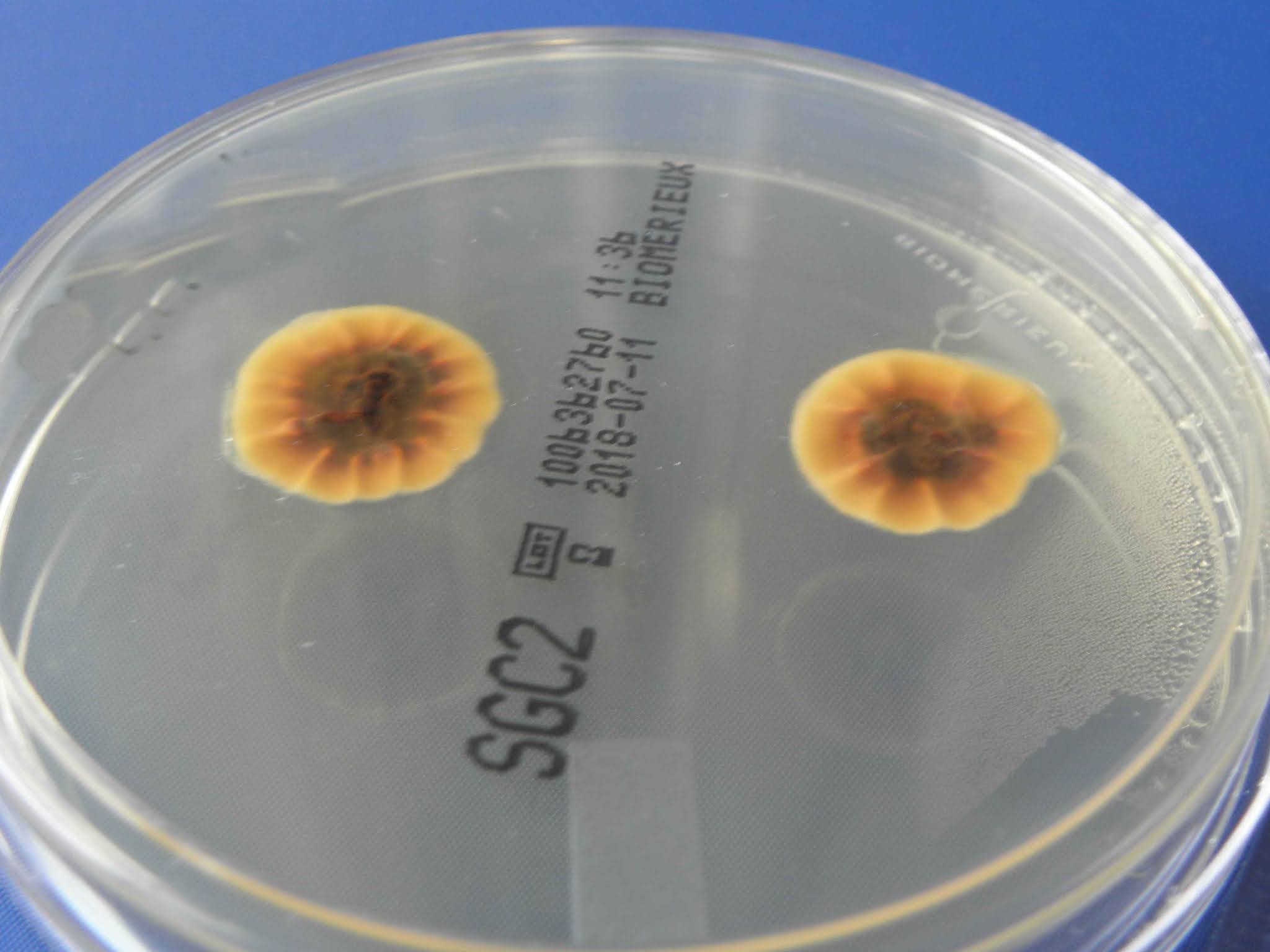 ATLAS MICOLOGIA: TRICHOPHYTON SOUDANENSE (II)