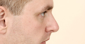 Weak chin Female, Male, Test, Celebrities - Health Care Tips and ...