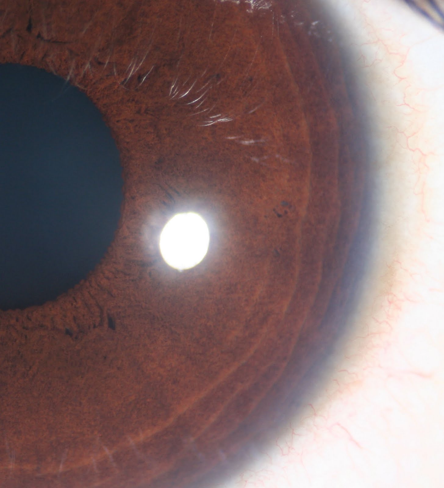 Modern & Multidimensional Iridology: Defect Marking Converge with ...