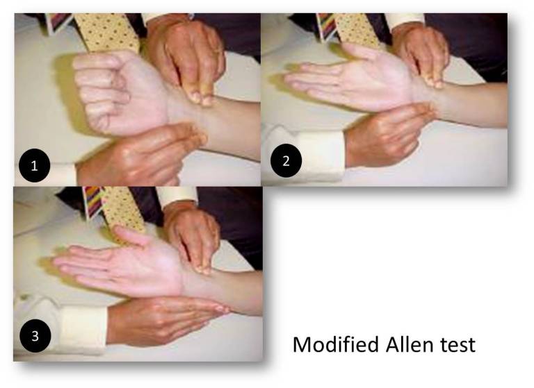 SOP PENGAMBILAN DARAH ARTERI