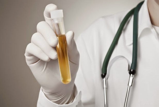 Treatment For Kidney Disease Which Tests Can Help You Diagnose Chronic treatment-for-kidney-disease-which-tests-can-help-you-diagnose-chronic