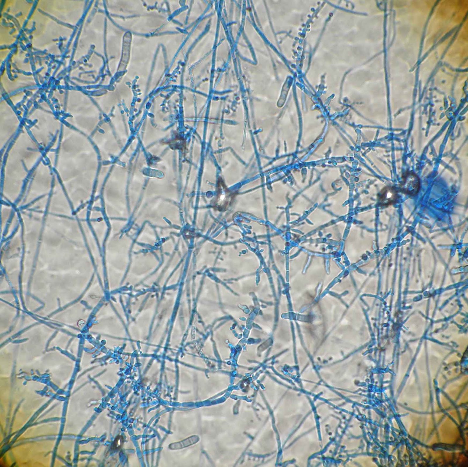 ATLAS MICOLOGIA: TRICHOPHYTON INTERDIGITALE