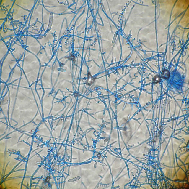 ATLAS MICOLOGIA: TRICHOPHYTON INTERDIGITALE