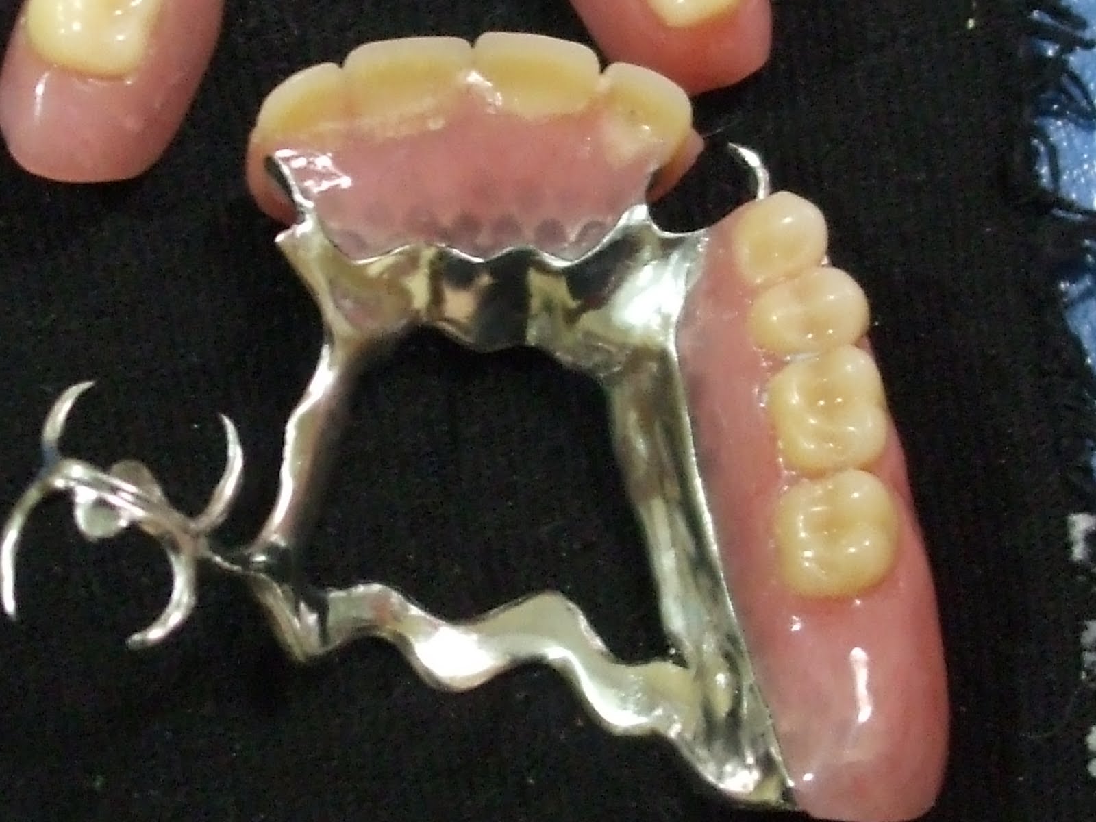 FER-DENTAL-LAB: PPR METALICAS