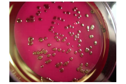 ENDO Agar - Microbiology Laboratory Turkey