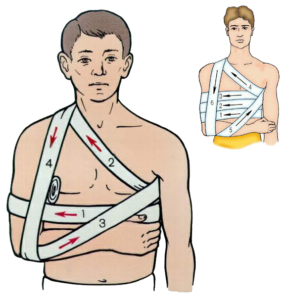 ATENSALUD: Enfermaría Geriátrica y Sociosanitaria: Técnicas de Vendaje