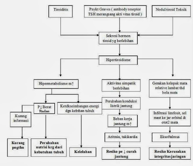 SISTEM ENDOKRIN : Hipertiroid