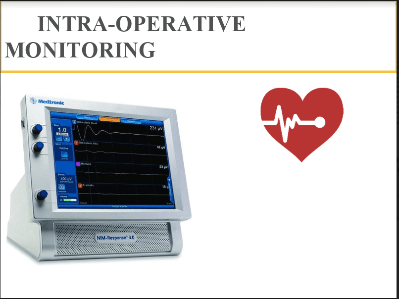 INTRA OPERATIVE MONITORING BY VAISHALI SYAL MAM