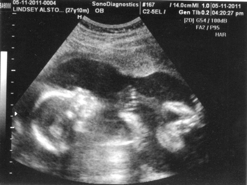 Making plans: Baby Boy Smith 19 weeks