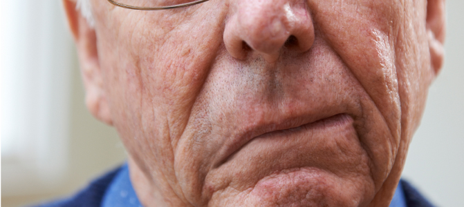 Silent Stroke Can You Have A Stroke Without Knowing It silent-stroke-can-you-have-a-stroke-without-knowing-it