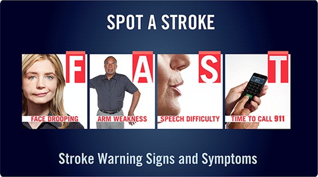 Dr. Deena's Daily Dose: Learn about the symptoms of stroke! Be FAST to ...
