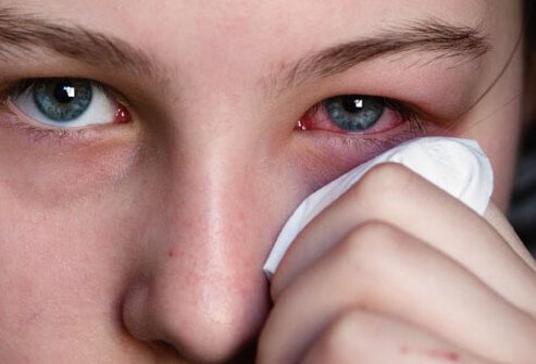 What Facts Should You Know About Eye Pain?