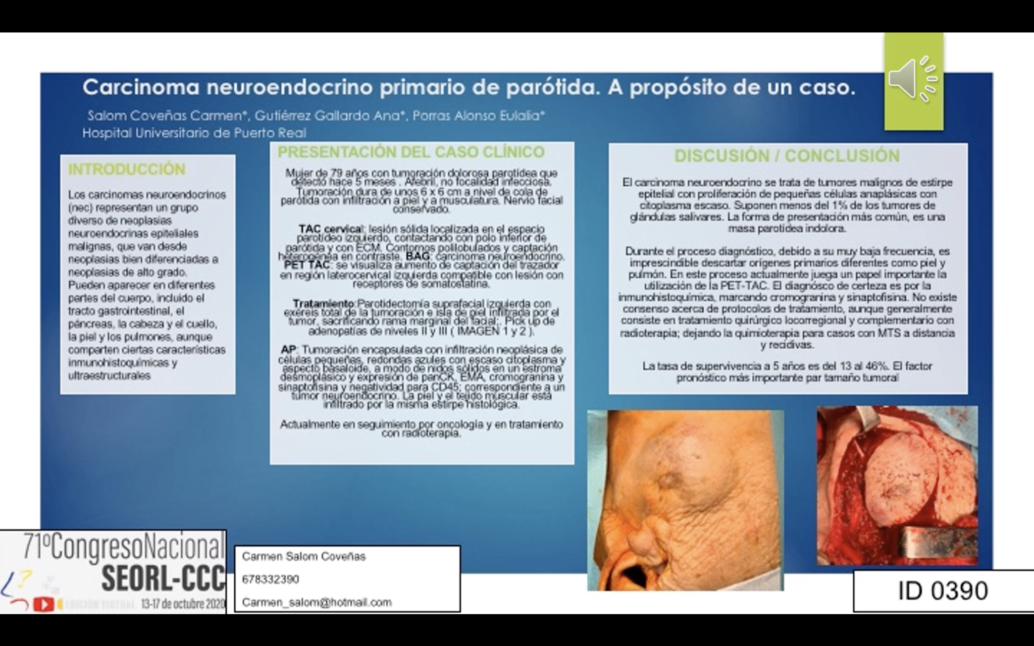 ORL - PUERTO REAL: 71 Congreso de la SEORL CCC