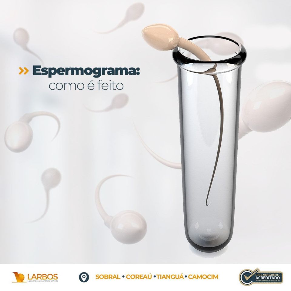 CAMOCIM ONLINE: ESPERMOGRAMA: COMO É FEITO?