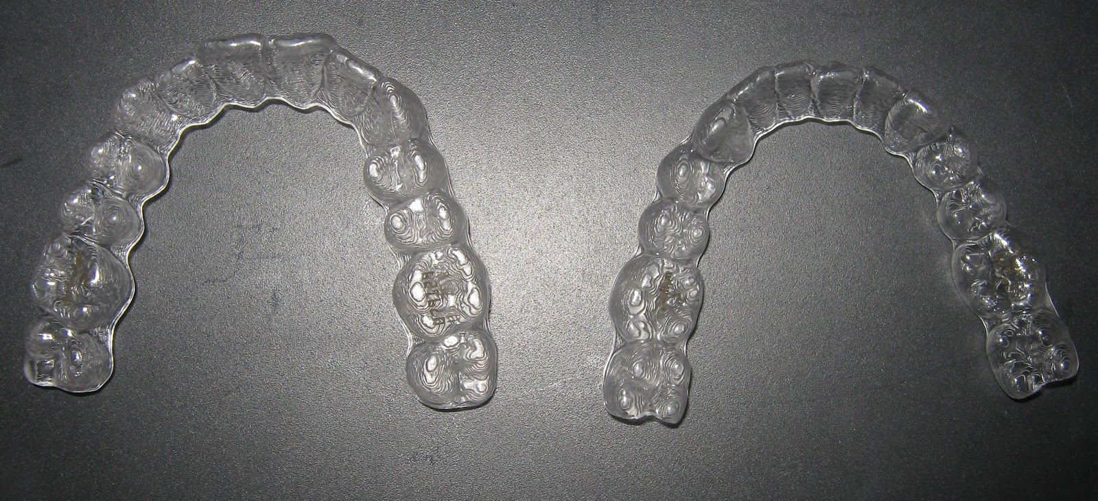 Br@ndy's Invisalign Journey: Tray 20!