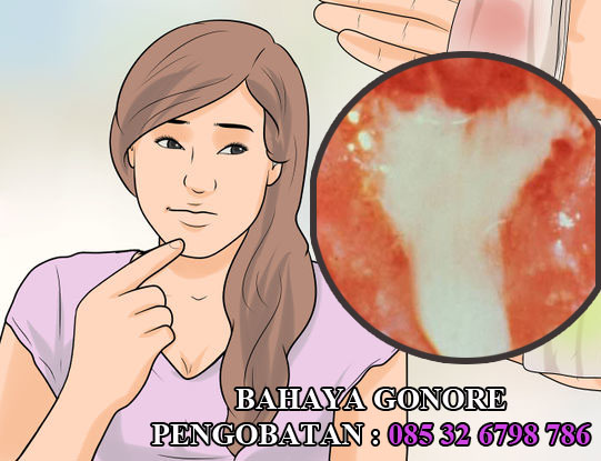 Ciri Ciri Khusus Penyakit Gonore Perempuan | Mencegah Gonore Kencing Nanah