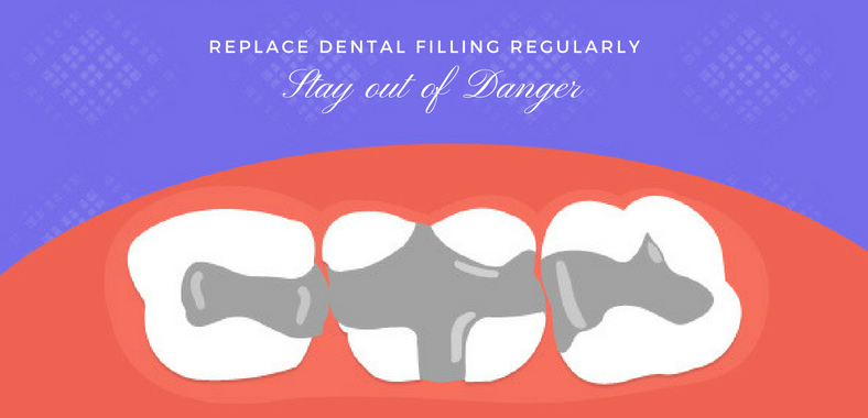 Replace Dental Filling Regularly: Stay out of Danger - Latest Dental ...