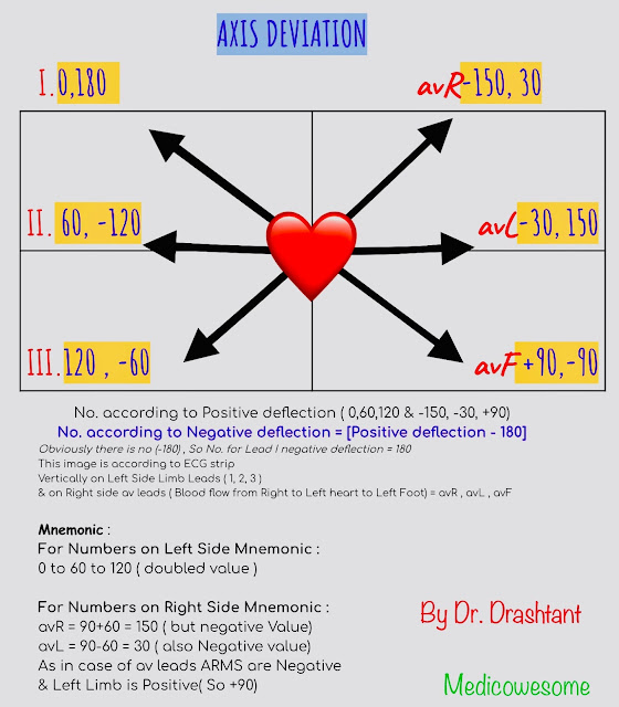 Medicowesome: All mnemonics for how to determine axis deviation of EKG