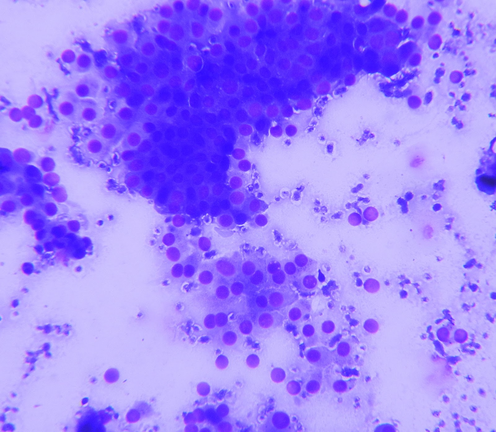 Into The Roots Some Thyroid Lesions into-the-roots-some-thyroid-lesions