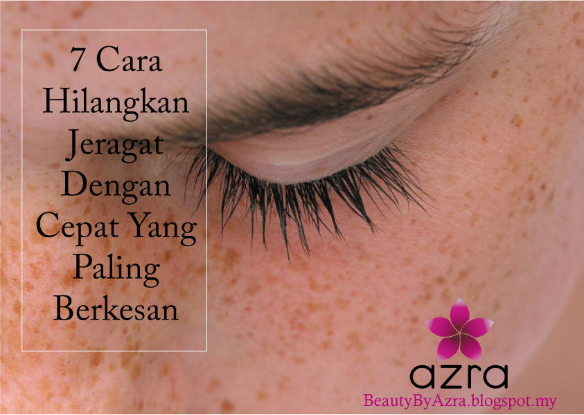 Cara Hilangkan Jeragat Dengan Cepat Yang Paling Berkesan - Beauty By Azra