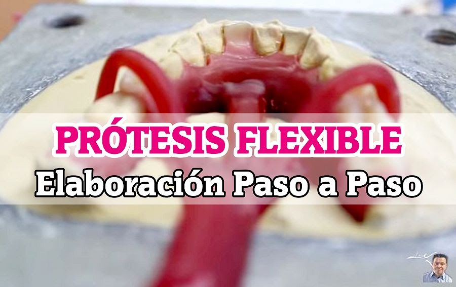 PRÓTESIS FLEXIBLE Paso a Paso - CD - TPD Daniel Ávila - Odonto-Tv