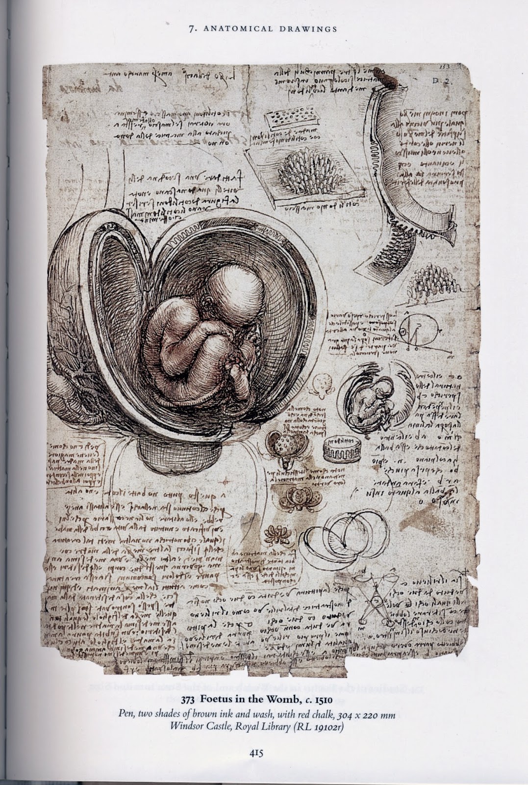 Right Mind Matters: Leonardo's Brain and Leonard Shlain