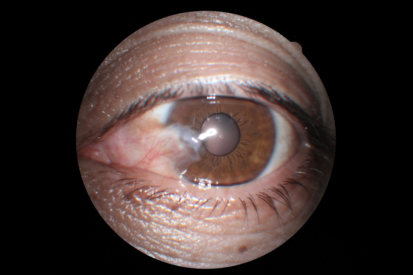 Eyes By Klein - Blog