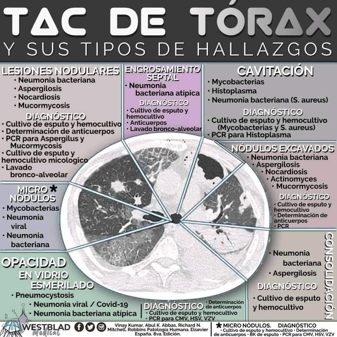 Blog del Dr. Sergio Castañeda Cerezo, MSc., F.A.C.P.: Infografía de TAC ...