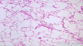 Microscope World Blog: Human Lungs under the Microscope