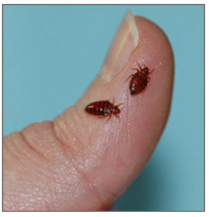 Ciri dan dampak digigit kepinding beserta penanganannya