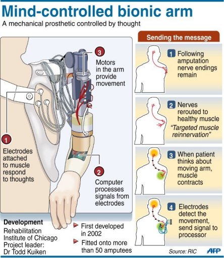 Biomedinova: A mechanical hand controlled by thought
