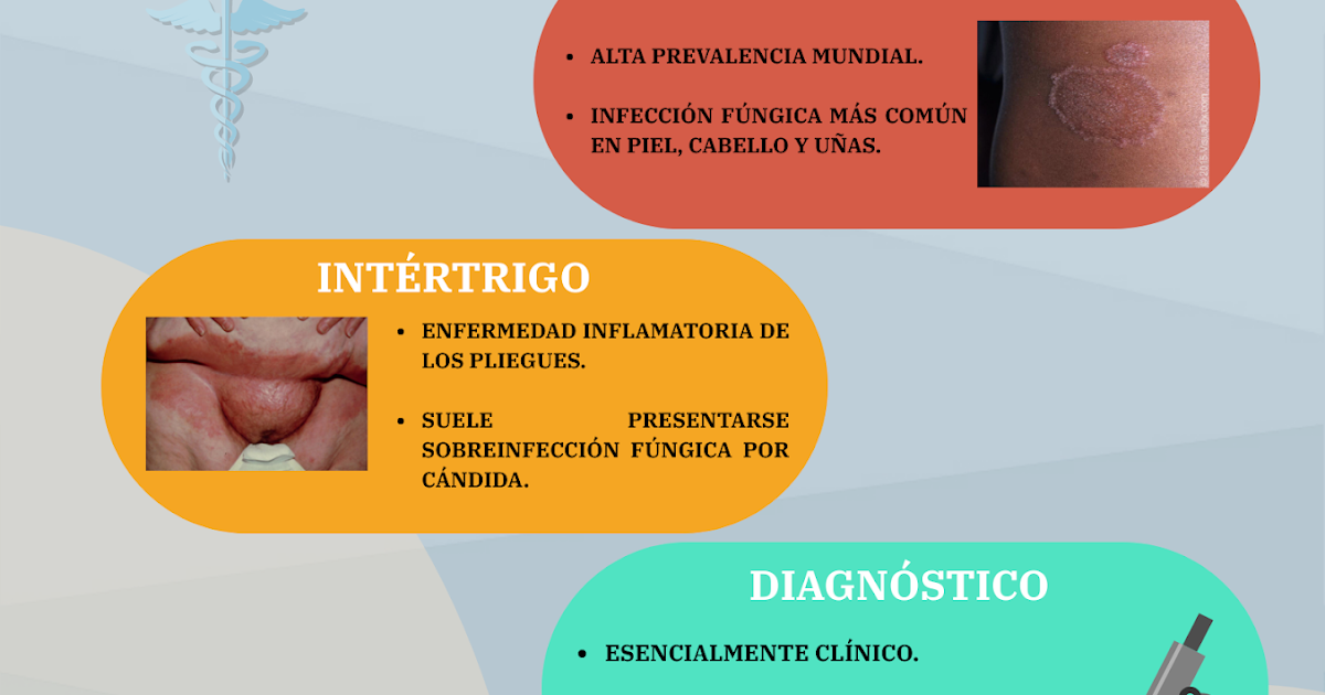 Salud Familiar UCM: Tiña e intértrigo, recomendaciones sobre ...
