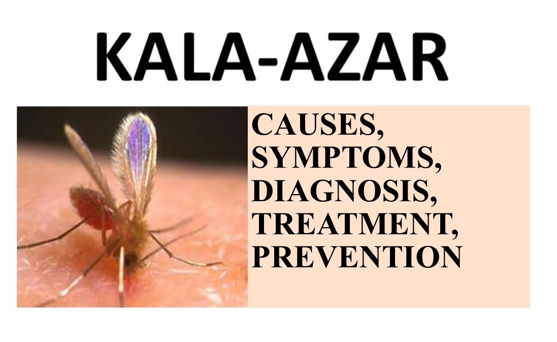 LEISHMANIASES ( KALA-AZAR ): CAUSES, SYMPTOMS, TYPES, DIAGNOSIS ...