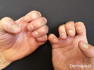 Dermapixel: junio 2021