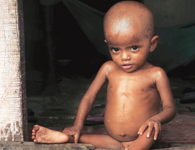 Prepare For Medical Exams Approach To A Case Of 3 Year Old Boy With prepare-for-medical-exams-approach-to-a-case-of-3-year-old-boy-with