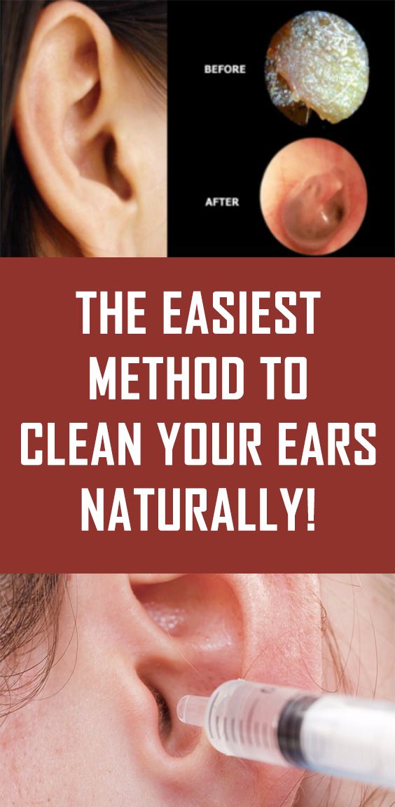 The Easiest Method To Clean Your Ears Naturally! - wellness magazine