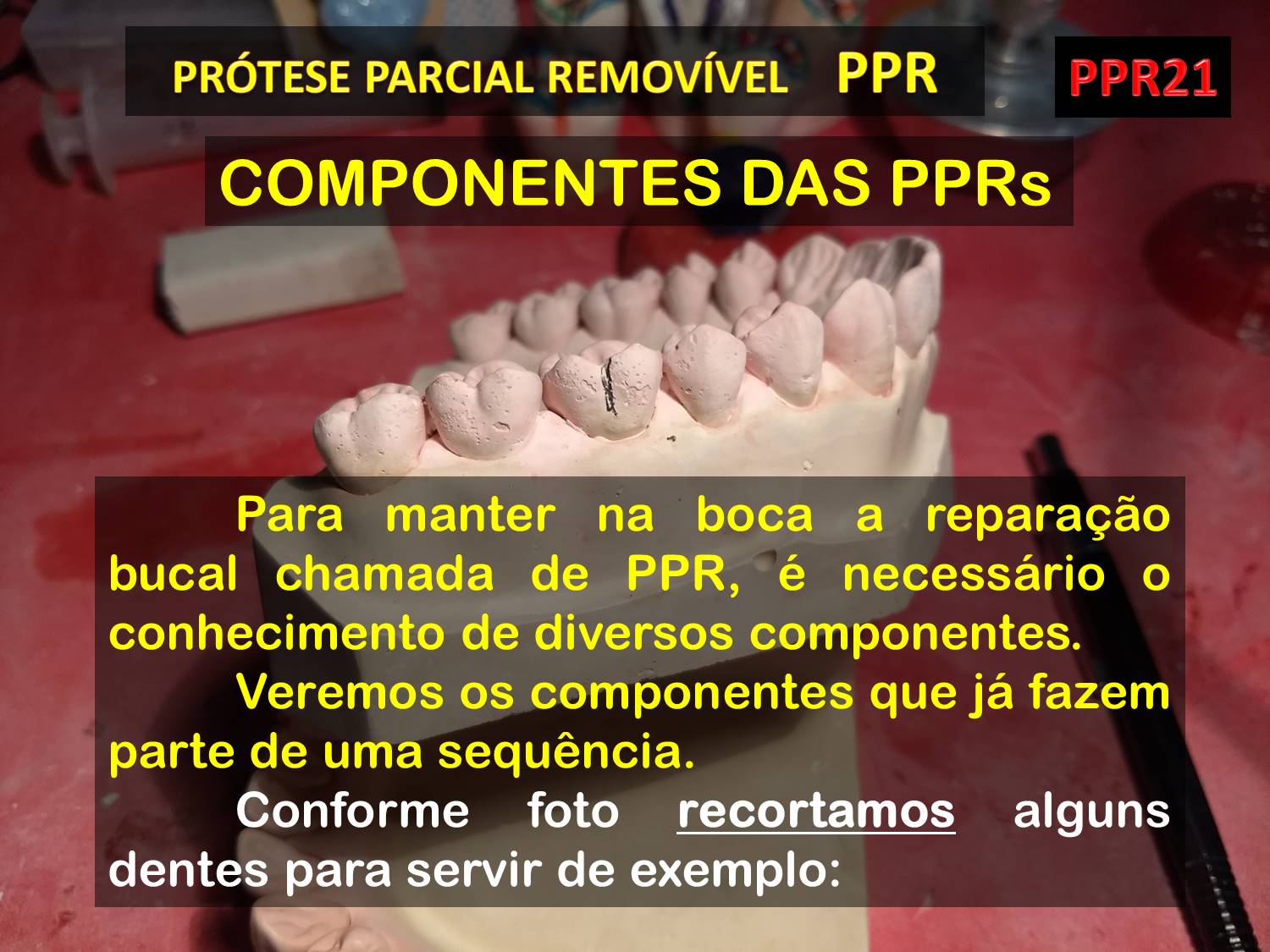 Professor Gilmar Zukowski gilmarprotese.blogspot.com : 3ºANO PPR ...