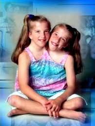 Enfermedades raras: Gemelo parásito (Fetus in fetus)