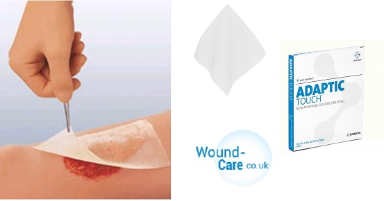 Wound Dressings-The Healing Expert