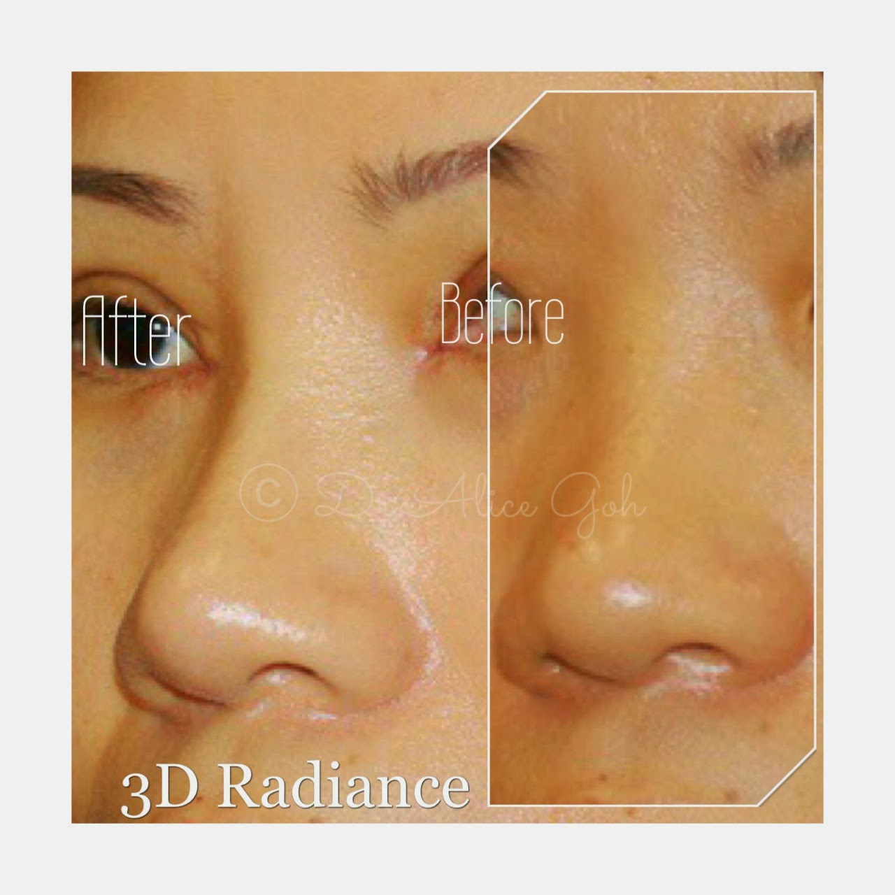 Dr. Alice Goh: September 2014