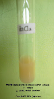 Rizqi Murtafi'ah: Pemeriksaan Urinalisis Lengkap