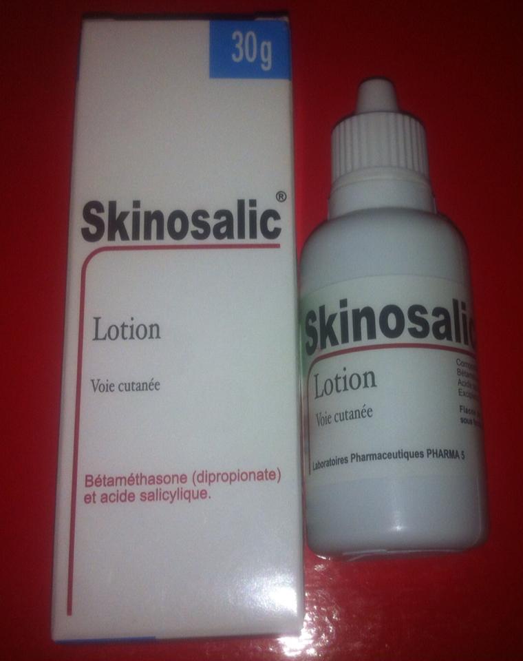 That Girl... is me !: Le psoriasis du cuir chevelu