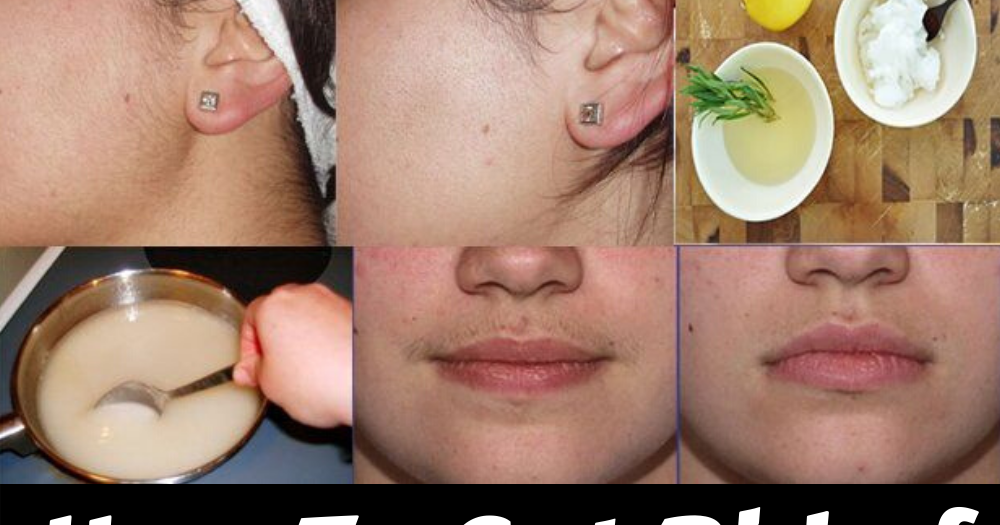 How To Get Rid Of Facial Hair Naturally Permanently At Home 5 Natural