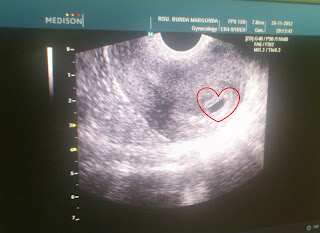 Learning from life: Diary Kehamilan, 28 Nov 2012