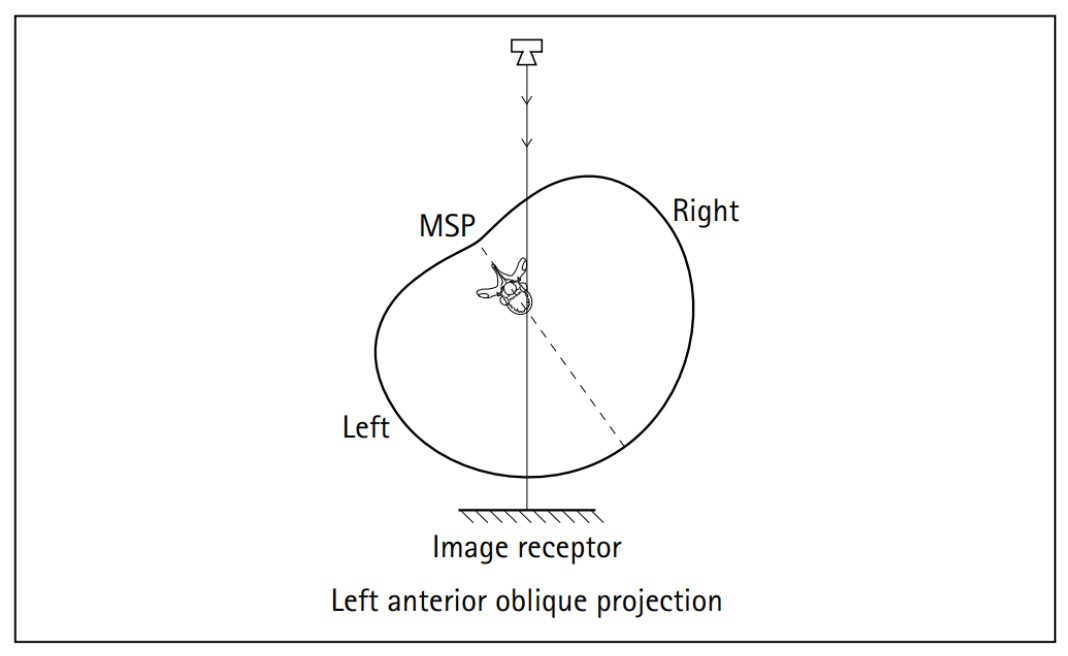 Clark's Radiography: Projection Terminology