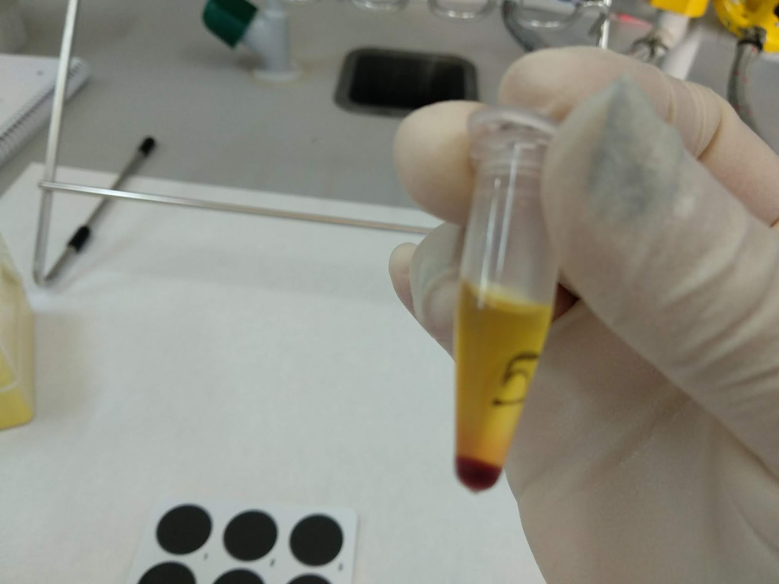 Técnicas de inmunodiagnóstico: Práctica 8: Factor reumatoide