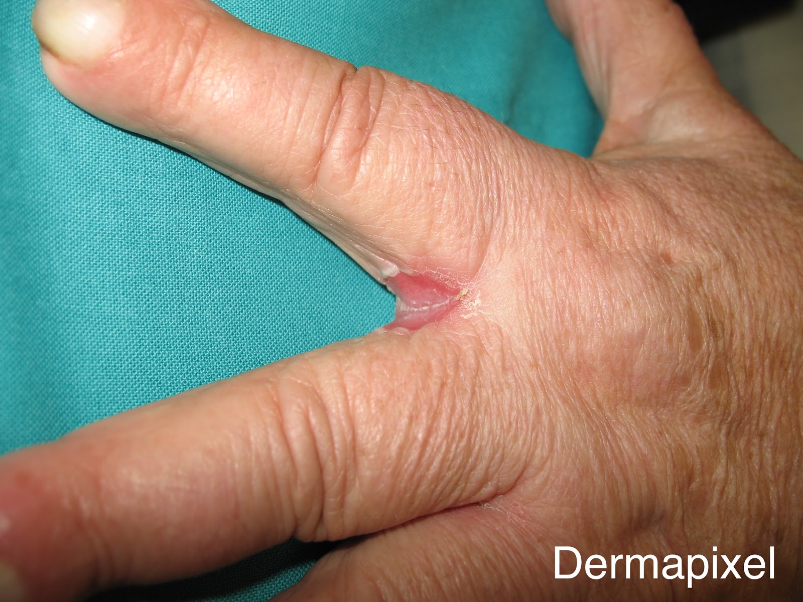 Dermapixel: junio 2018